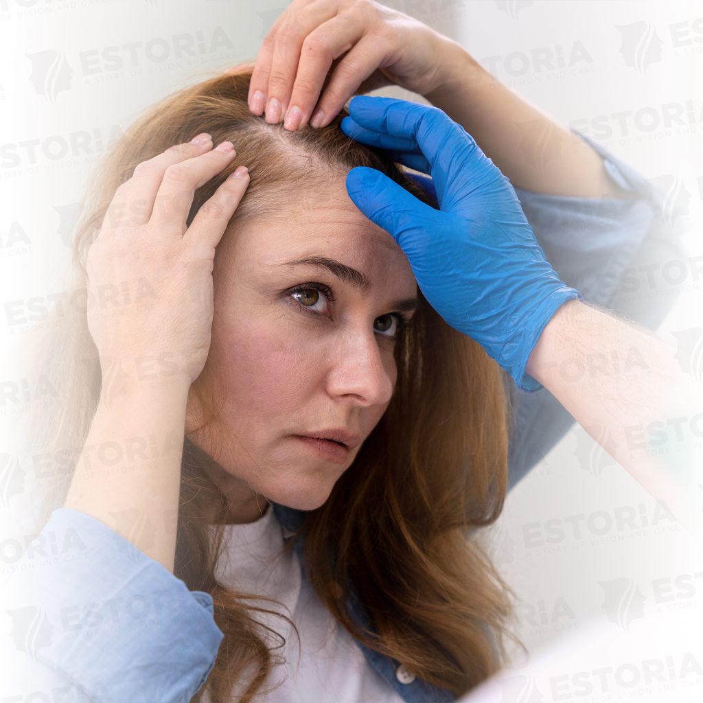 Woman Hair Transplant - Private Estoria Polyclinic